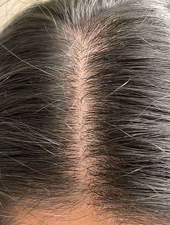 Jupiter® | Elevated Hair Products for Dandruff & Dry Scalp